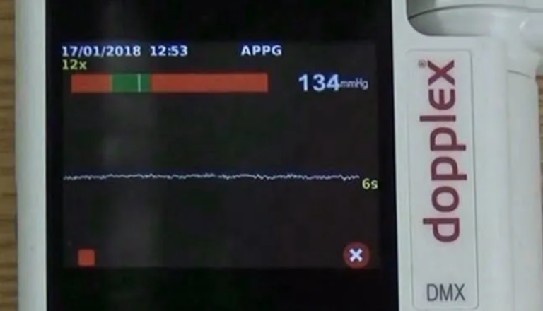 Ankle and Toe Pressure (ATP) Kit Guide Knowledge - Huntleigh Healthcare ...
