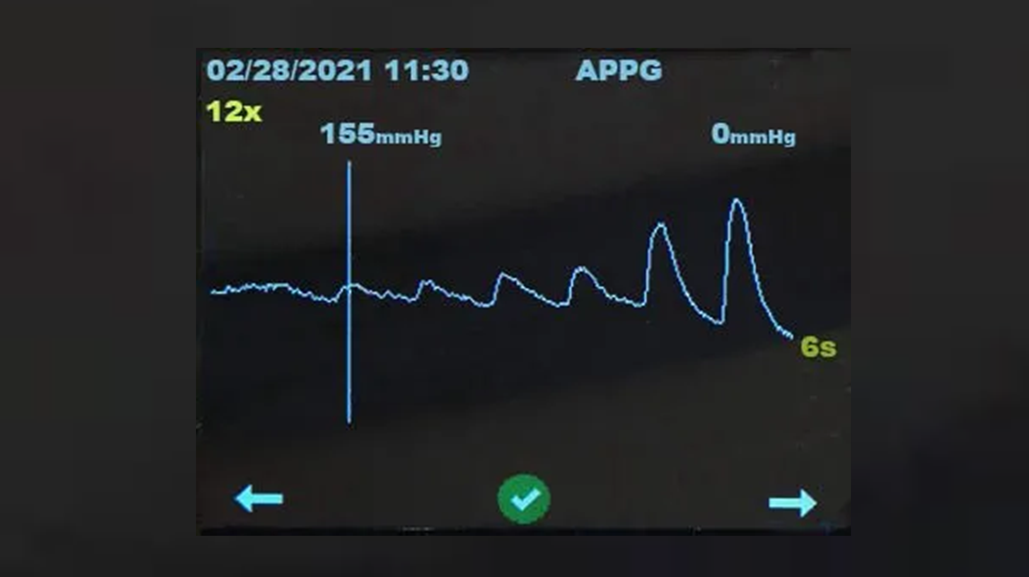 Ankle and Toe Pressure (ATP) Kit Guide Knowledge - Huntleigh Healthcare ...