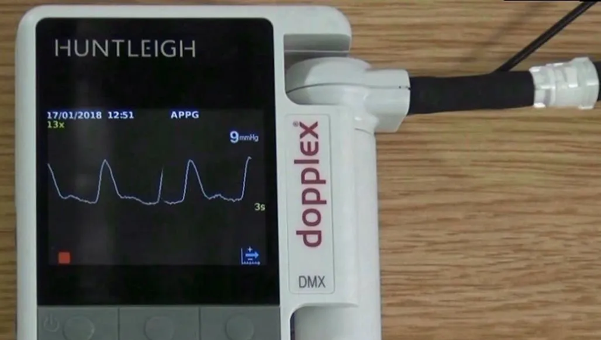 Ankle and Toe Pressure (ATP) Kit Guide Knowledge - Huntleigh Healthcare ...